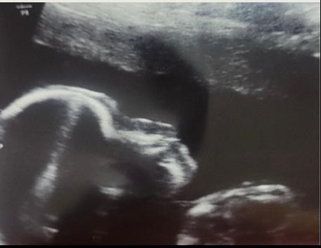 Ivan Rabadan Obituary - Houston, TX