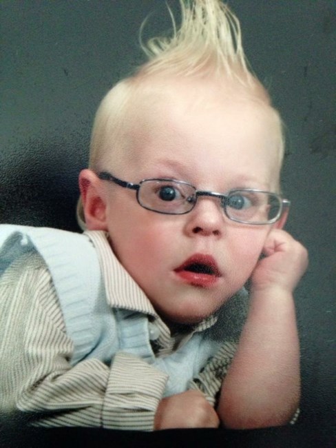 down syndrome mohawk