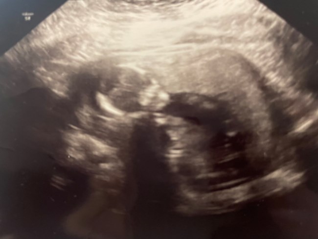 Aziel Gonzalez Obituary - Houston, TX