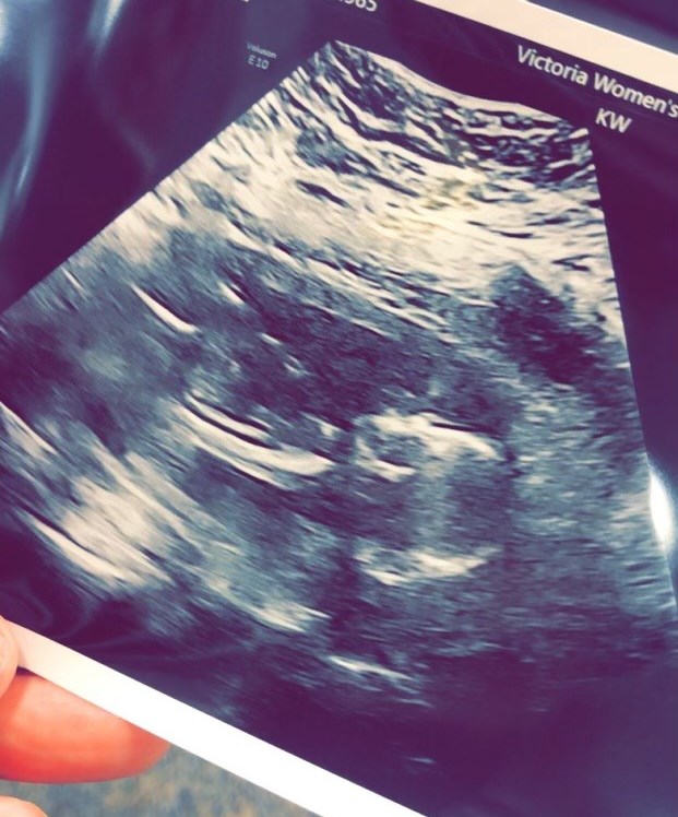 Jaxson Leo Lopez Obituary - Port Lavaca, TX